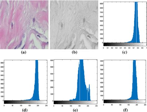 A B Shows A Histopathological Image From The Data Base And Its Download Scientific Diagram