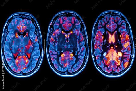 Brain Scan A Detailed Image Of An Mri Brain Scan Showing Different