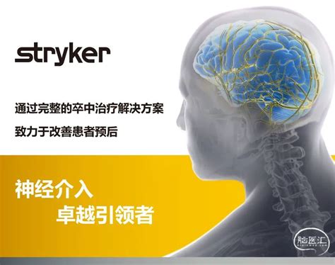 Time To Evolve 超越之旅 Surpass Evolve治疗左侧椎动脉v4段夹层动脉瘤 脑医汇