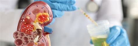 Understanding The Presence Of Nitrite In Urine