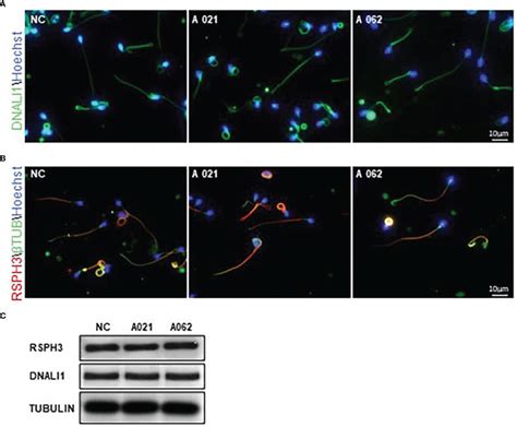 Identification Of Bi Allelic Kif9 Loss Of Function Variants Contributing To Asthenospermia And