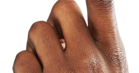 Are Bandaid Companies Racist For Just Now Making Black Skin Tone