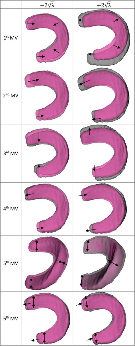 First Six Principal Morphological Variations Mean Model Shown In Pink