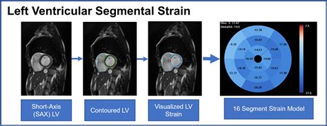 Lv Strain Reproducibility Elbaz Pic Cvi Lab Northwestern University