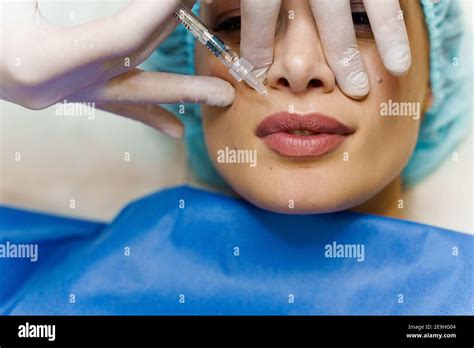 Closeup Lips Augmentation Injections For Attractive Girl Plastic Surgeon Does Injection In Lip