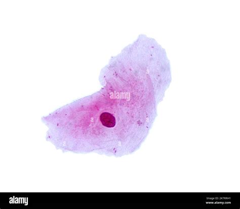 Light Micrograph Of A Buccal Smear Showing Desquamated Squamous Cells