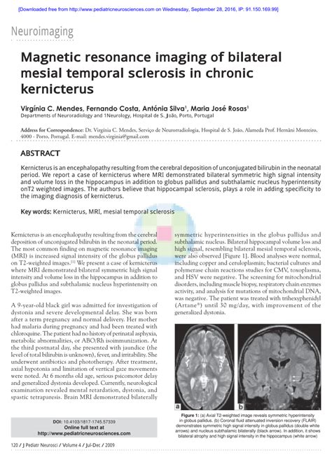 Pdf Magnetic Resonance Imaging Of Bilateral Mesial Temporal Sclerosis