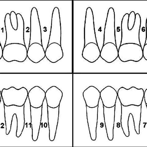 Cephalometric Measurements 1 Sna Angle 2 Snb Angle 3 Anb