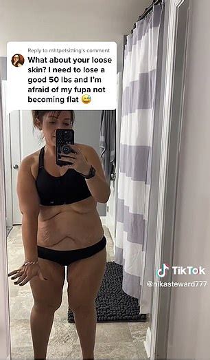 Kim Kardashian S Doctor Says He S Seeing Saggy Skin And Deflated