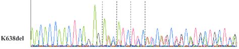 Figure3 Sequencing Electropherogram Of The Control Upper And Ii 3 Download Scientific Diagram
