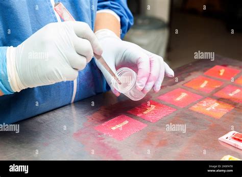 Biopsy Samples Being Processed At The Pathology Laboratory To Be