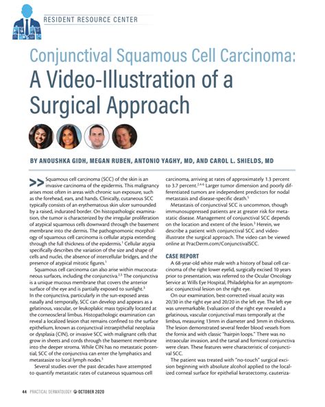 Pdf Conjunctival Squamous Cell Carcinoma A Video Illustration Of A