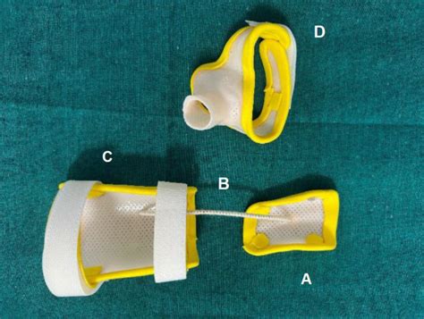 The Effect Of A Modified Tenodesis Wrist Hand Orthosis On Hand Function