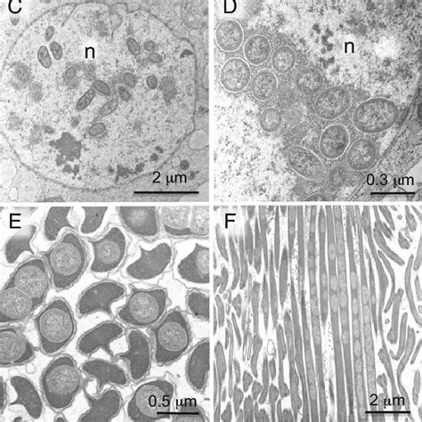 Transmission Electron Microscopy Of Nuclear Localization Of The Download Scientific Diagram