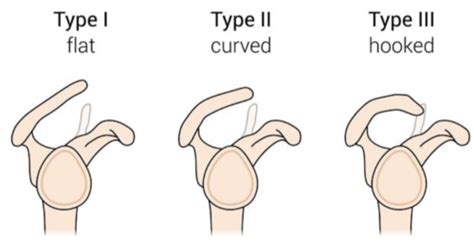 Impingement Bursitis Flashcards Quizlet