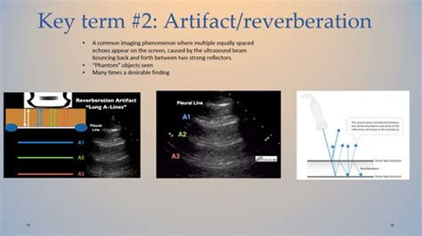 Ultrasound Flashcards Quizlet