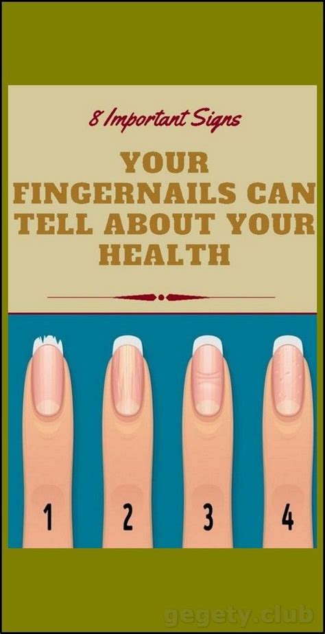 8 Important Signs Your Fingernails Can Tell About Your Health Artofit