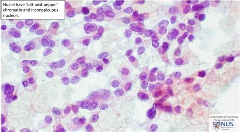 Thyroid Cytoweb Practical Cytopathology