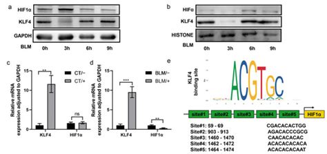 Ijms Free Full Text Overexpression Of Klf4 Suppresses Pulmonary