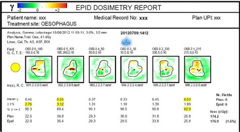 Epid Dosimetry Report Showing The Results Of A 2d Epid Based In Vivo