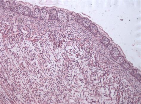 Photomicrograph Showing Sequential Evagination And Invagination Of The