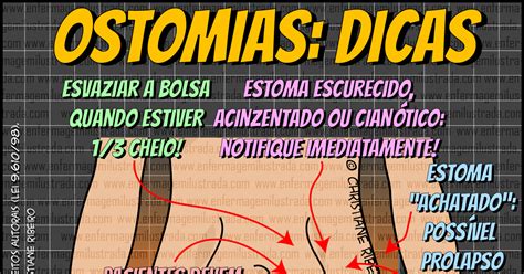 Cuidados Com Os Estomas Intestinais E Urinários Enfermagem Ilustrada