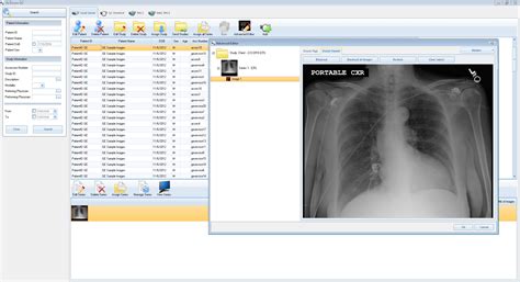 PACS EMR Enhance Your Facility S Imaging Capabilities