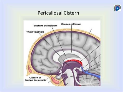 Cisterns Of Brain