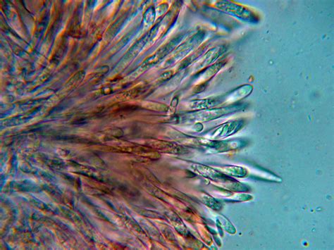 Lachnum Impudicum Pubescens Microscopía Foro De Micología