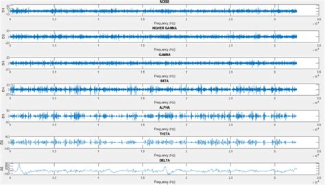 Decomposition Of Eeg Signal In Various Frequency Bands Using Db6 With 6
