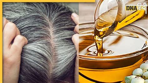 White Hair Remedy सफेद बालों से हैं परेशान तो इस एक तेल से करें मसाज