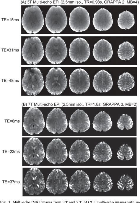 Figure 1 From Multi Echo Fmri A Review Of Applications In Fmri Denoising And Analysis Of Bold
