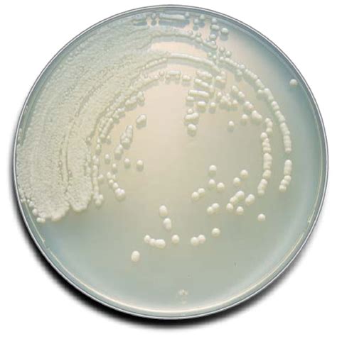 BD BBL Prepared Plated Media Mycosel Agar Deep Fill Mycosel Agar Deep Fisher Scientific