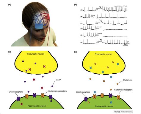 Transcranial Direct Current Stimulation Electrode Placement