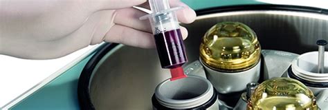 Arthrex Image Prp Berova Klİnİk Ortopedi Ve Travmatoloji