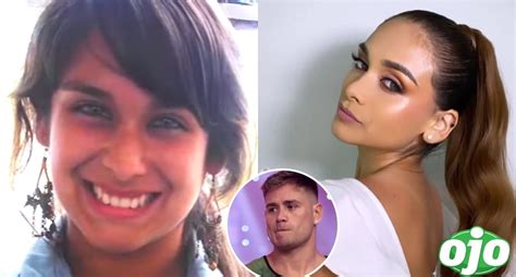 Cirugías De Nathaly Terrones Fotos De Su ‘antes Y Después Ojo Show