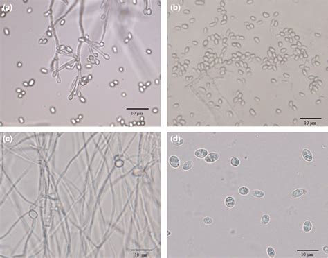 Microstructures Of Two Types Of Spores Produced By C Rosea 67‐1