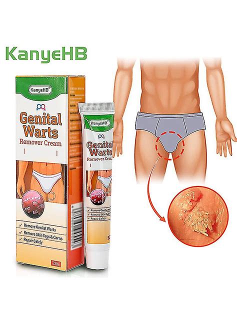 Genital Wart Remover Ointment Remove Skin Tags Corns Relieve Discomfort