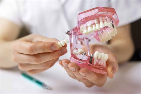 How Long Does It Take To Get Dental Implants Aspire Dental Wellness