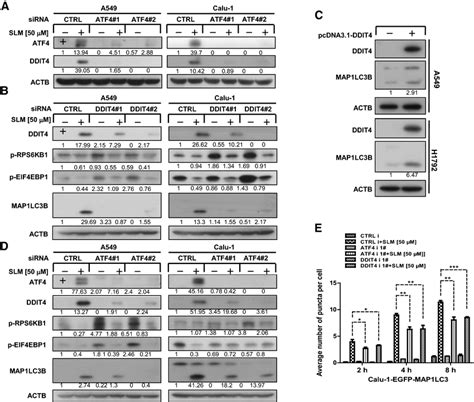Sirt12 Inhibition Induced Autophagy Via Atf4 Ddit4 Mtor Signaling