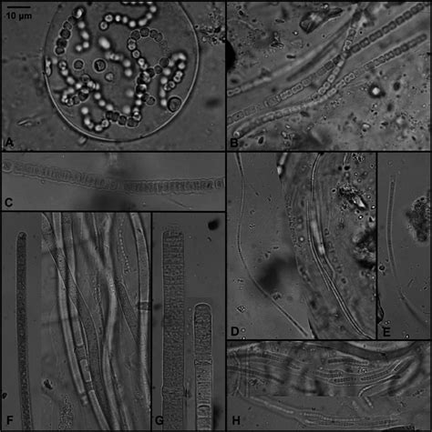 Diversity Of Cyanobacterial Morphotypes Identi Fi Ed In The Arti Fi