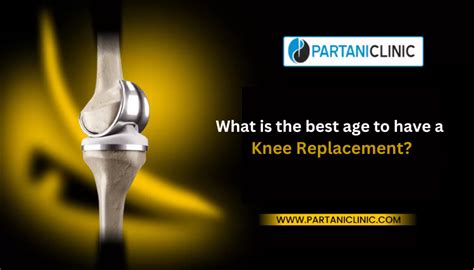 Best Age To Have A Knee Replacement Surgery Dr Arun Partani