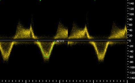 Advanced Echo Module Surgical Science