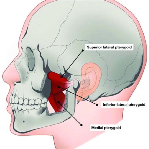 Masseter Muscle Recommended Injection Sites Download Scientific Diagram