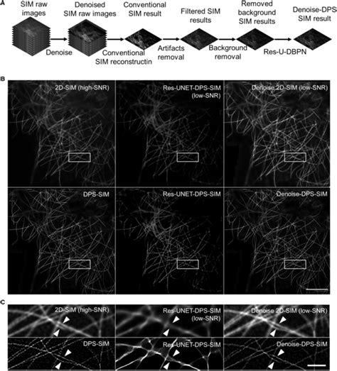 Universal And High Fidelity Resolution Extending For Fluorescence Microscopy Using A Single