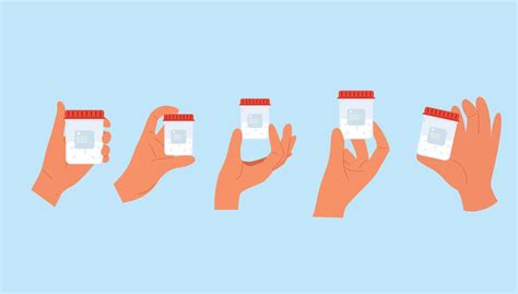 Set Of Illustrations With Semen Analysis Plastic Container For Sperm