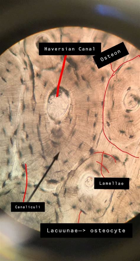 Bone Tissue Model Labeled Lab Lesson 6 The Skeletal System