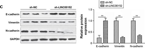 Knockdown Of Linc00152 Inhibits Cell Migration And Invasion In Oscc