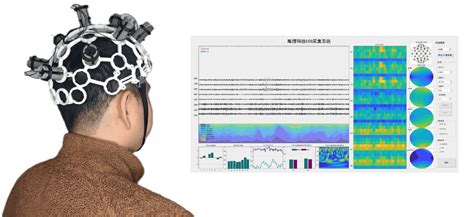 唯理多通道脑电图eeg采集仪 唯理科技 领先的生物电技术提供商