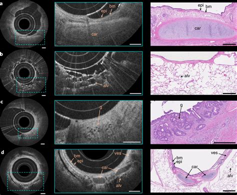 In Vivo And Ex Vivo Endoscopic Oct Using The Nano Optic Endoscope Ad